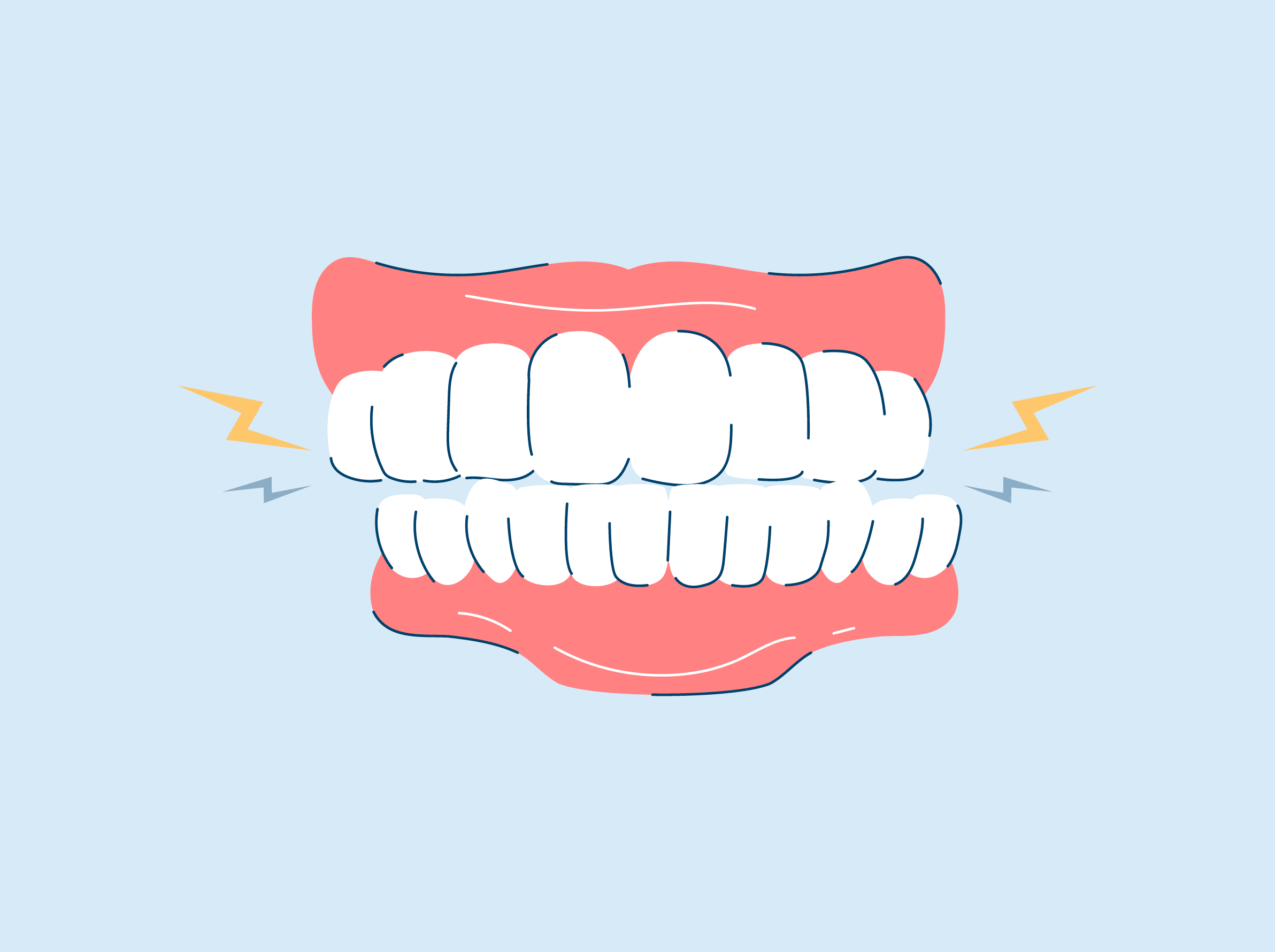 Bruxism Teeth Grinding Symptoms Causes And Treatments Snow® Oral