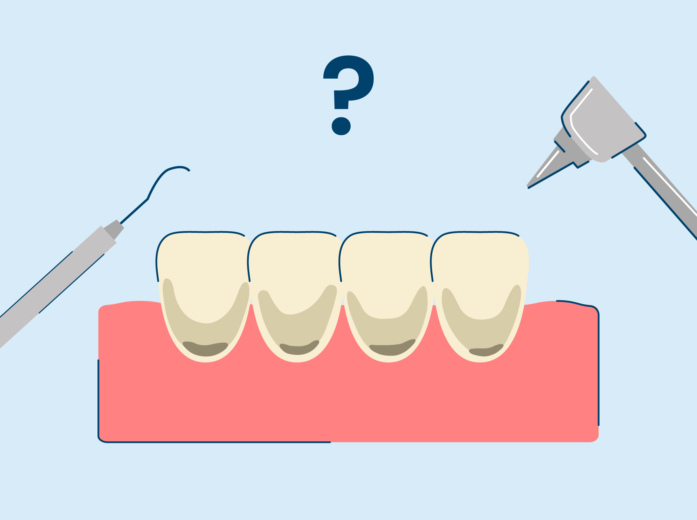 Damaged Tooth Enamel: Erosion and Repair