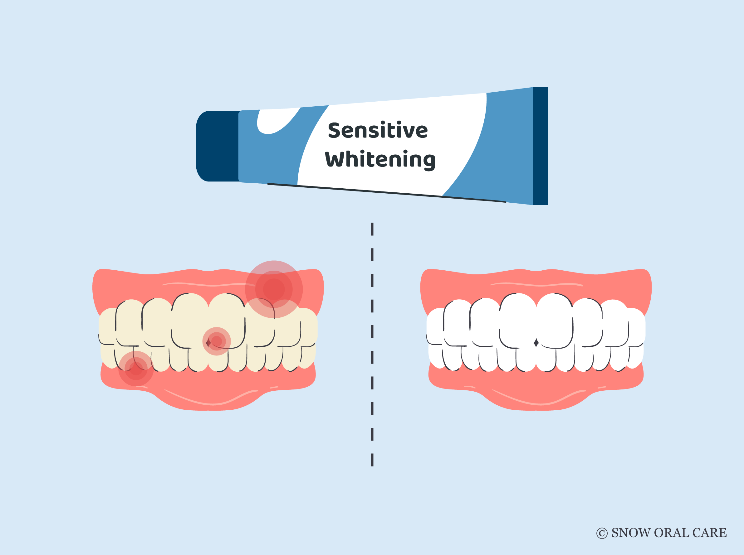 Best Sensitive Whitening Toothpaste: Top Solutions