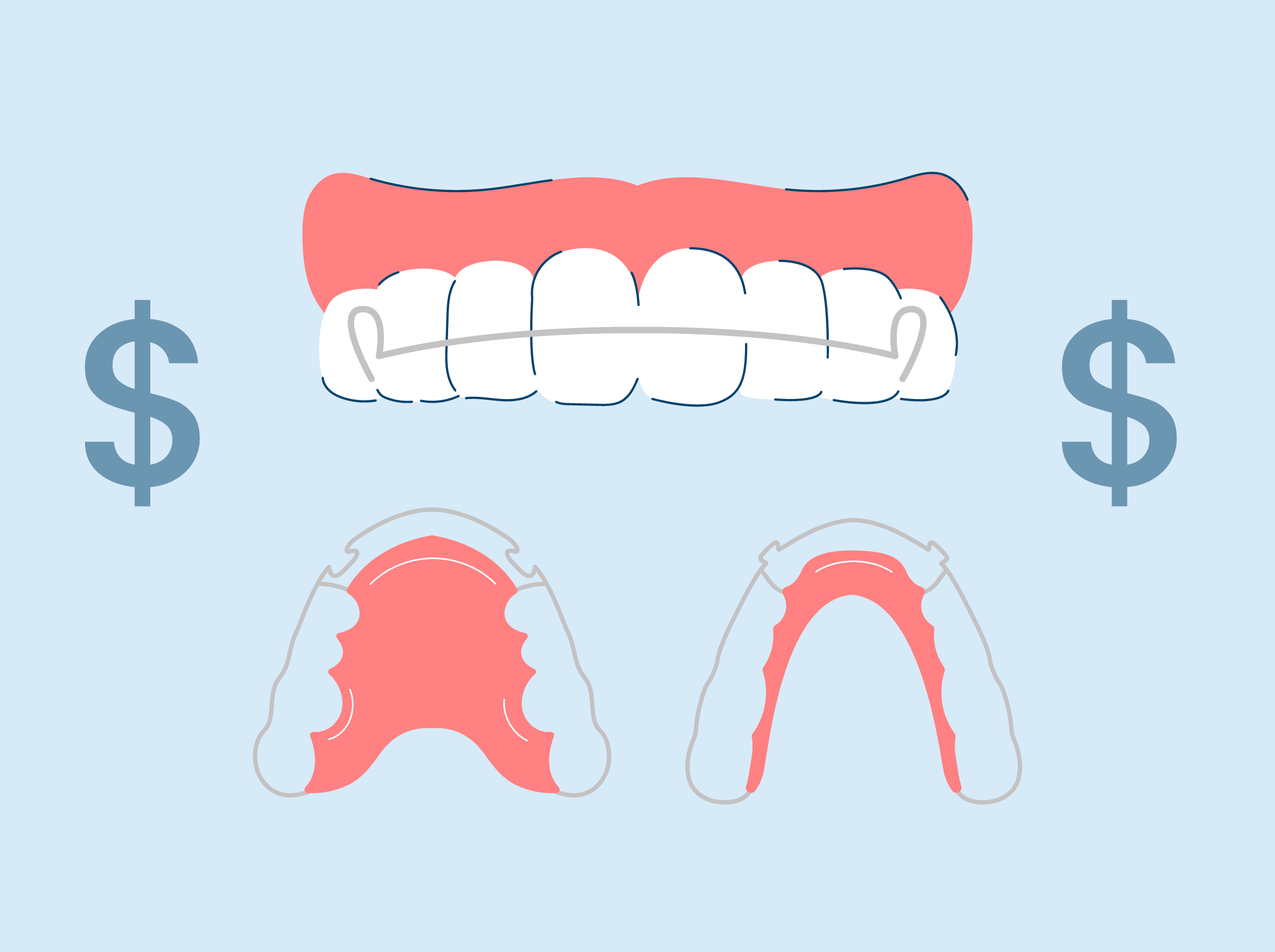 How Much Do Retainers Cost? Types, Benefits, and Care