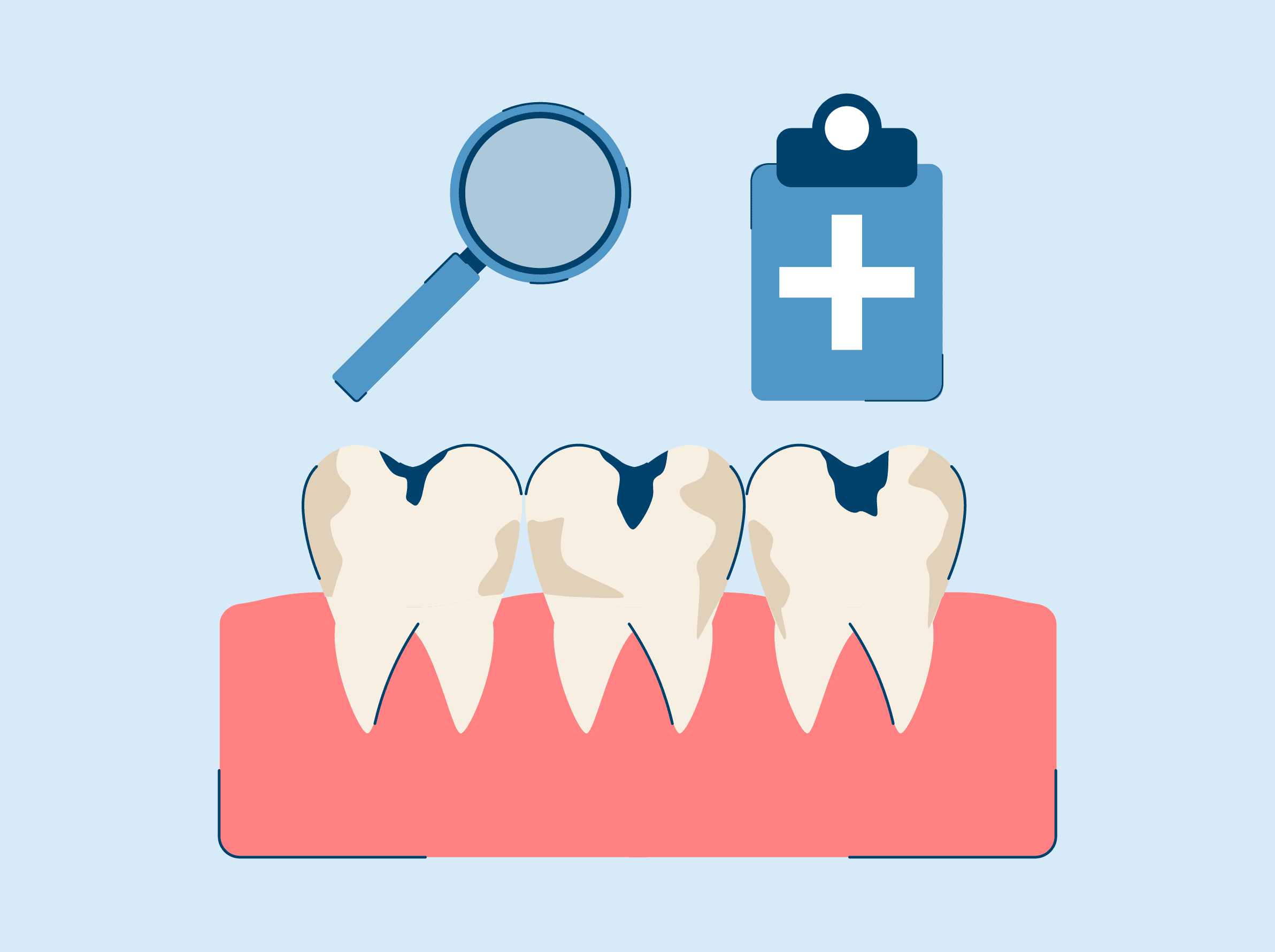 Rotten Teeth: Symptoms and Treatment – SNOW® Oral Care