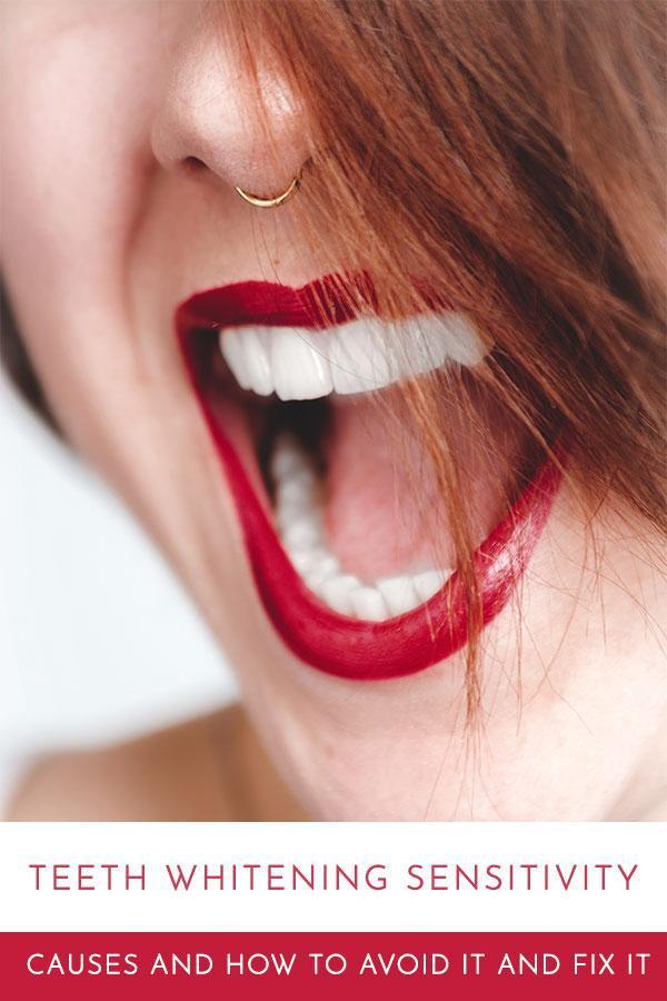 Teeth Whitening Sensitivity: Causes and How to Avoid it and Fix it