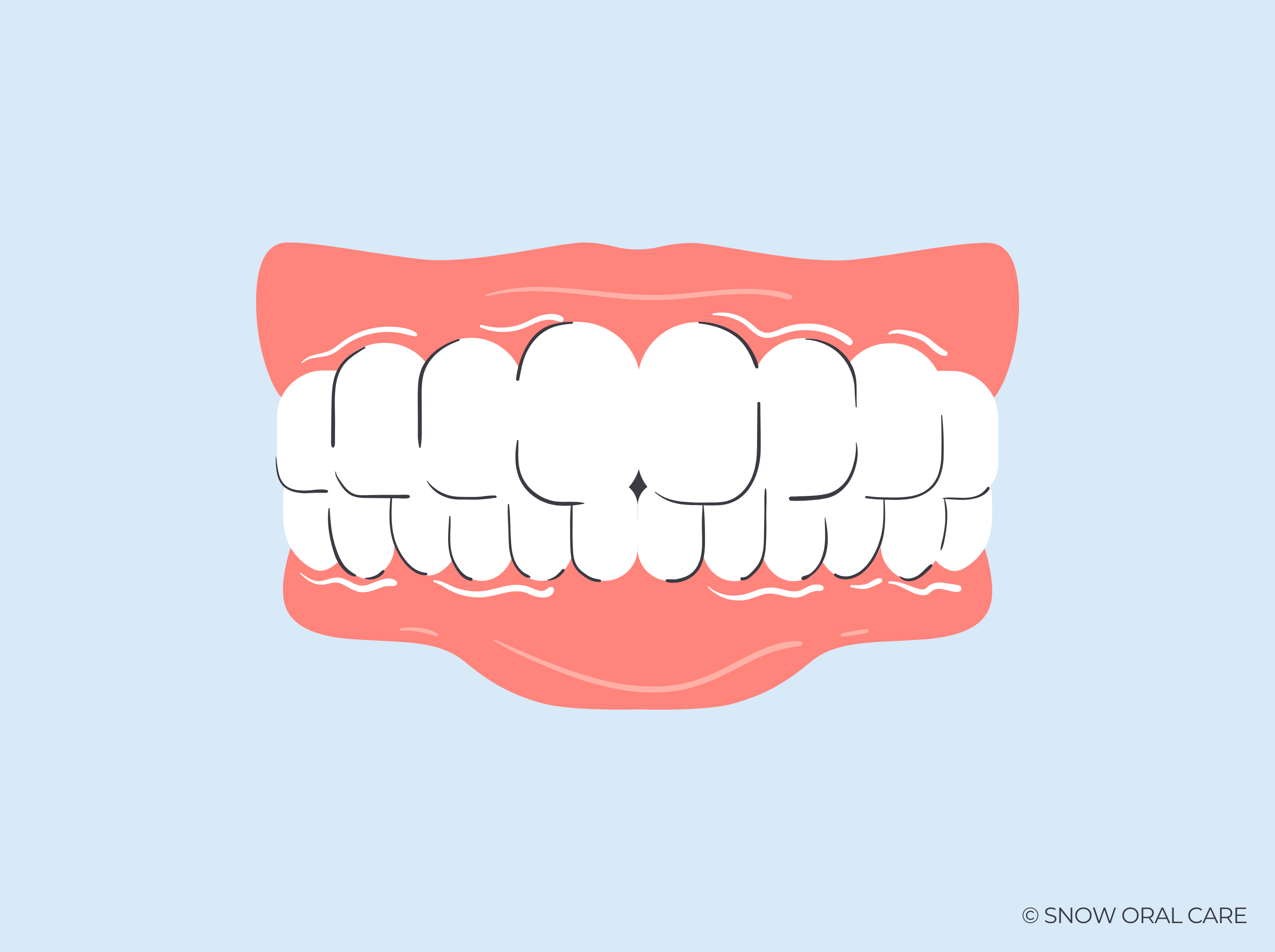 White Line on Gums Below Teeth: Should You Worry?