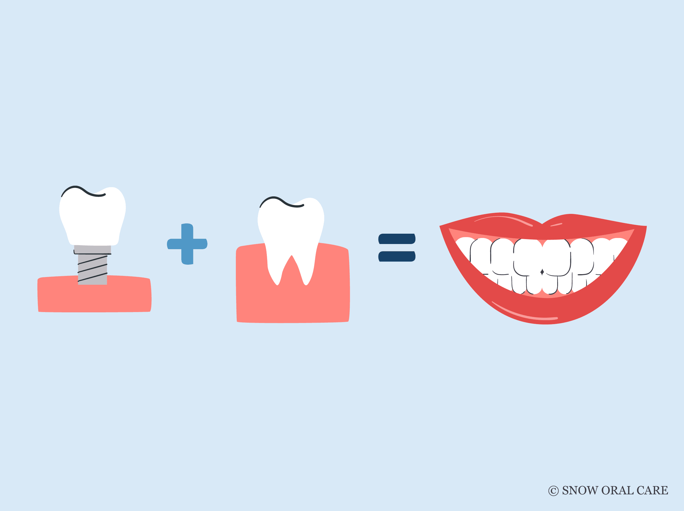 Whitening Fake and Real Teeth Together (Tips and Tricks) – SNOW® Oral Care