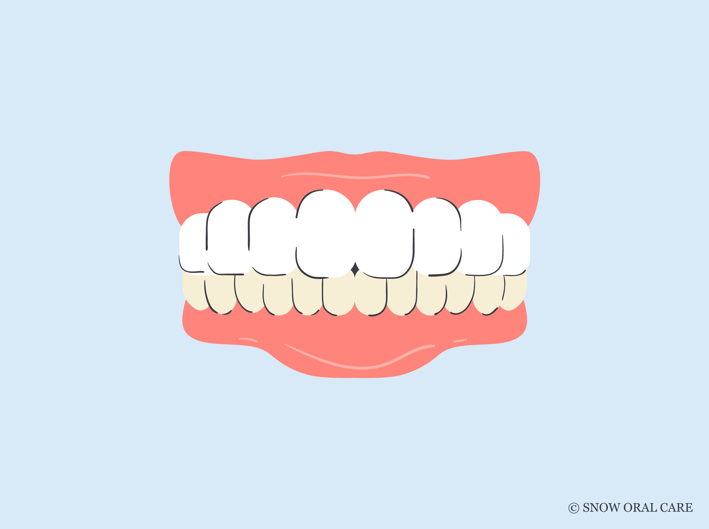 Why Are My Bottom Teeth More Yellow? | SNOW® Oral Care