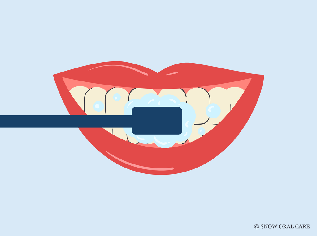 teeth yellow despite brushing